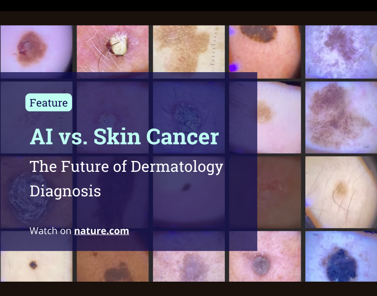 AI versus skin cancer: the future of dermatology diagnosis - Skin Analytics
